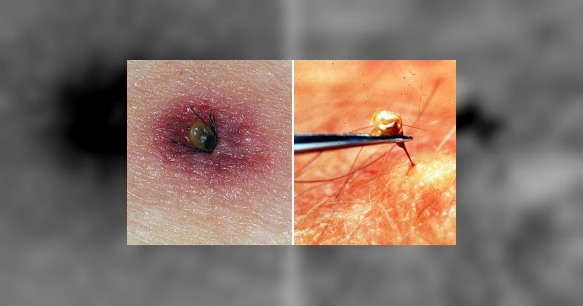 4 tipuri de muscaturi de INSECTE pe care nu trebuie să le ignori! A 4-a ...
