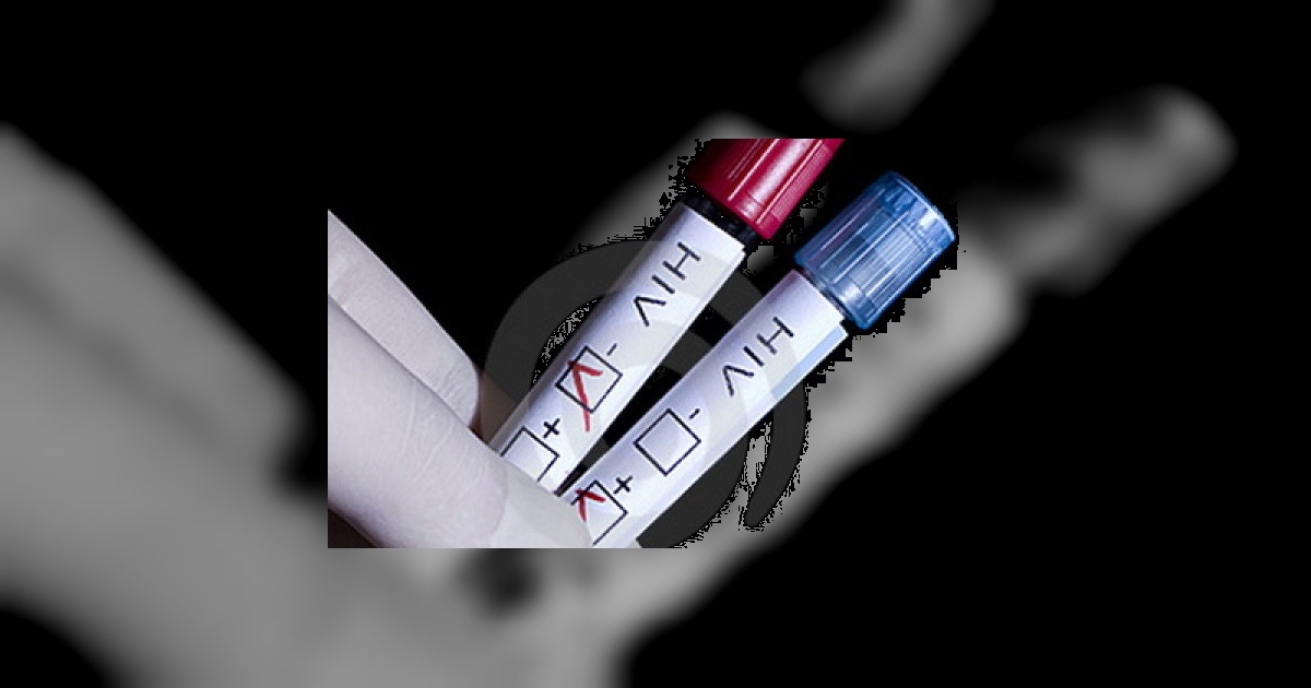 HIV - Tot ce trebuie sa stii despre o boala cumplita: cauze, simptome ...